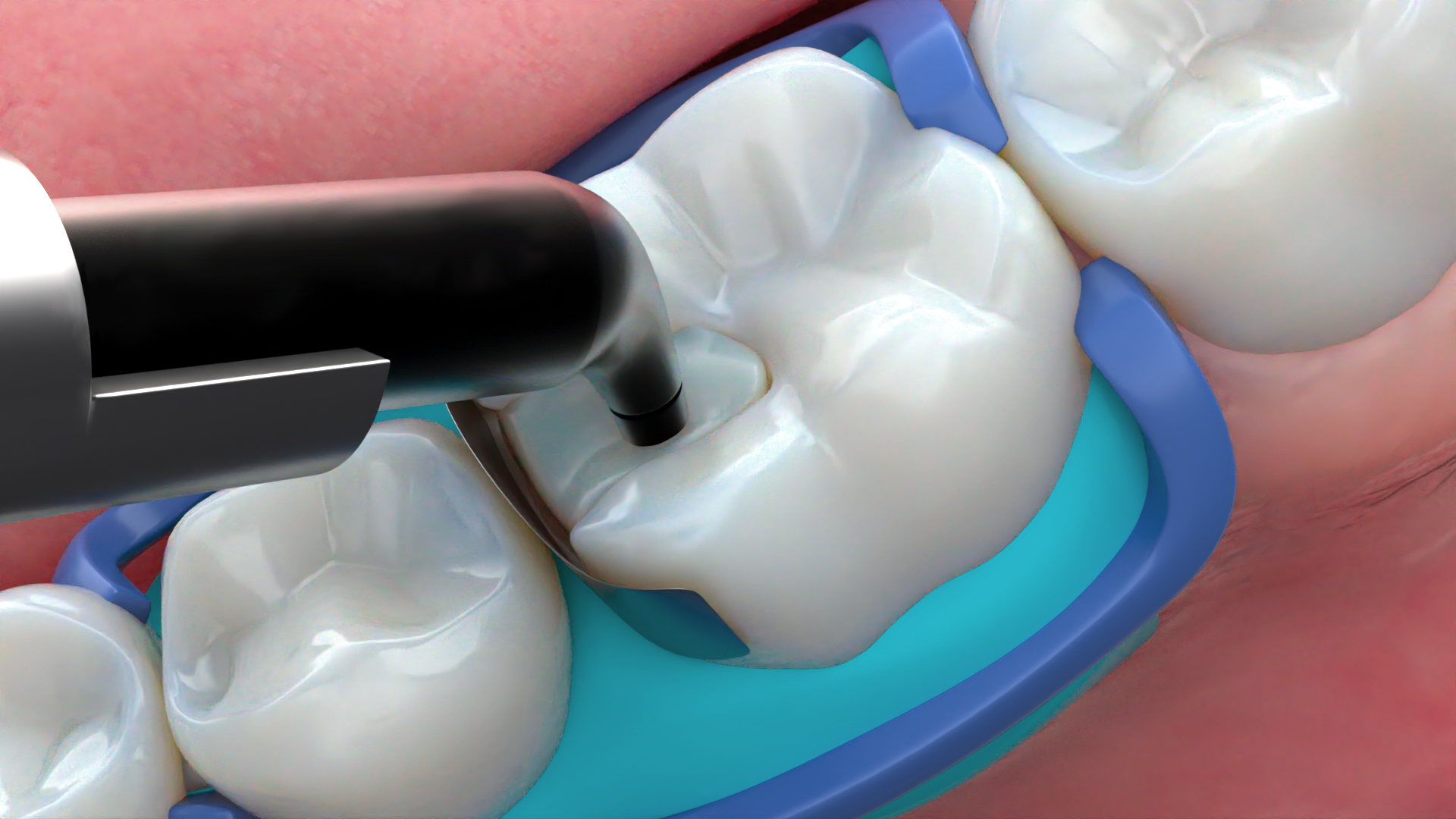 TheDentalGenius - Home