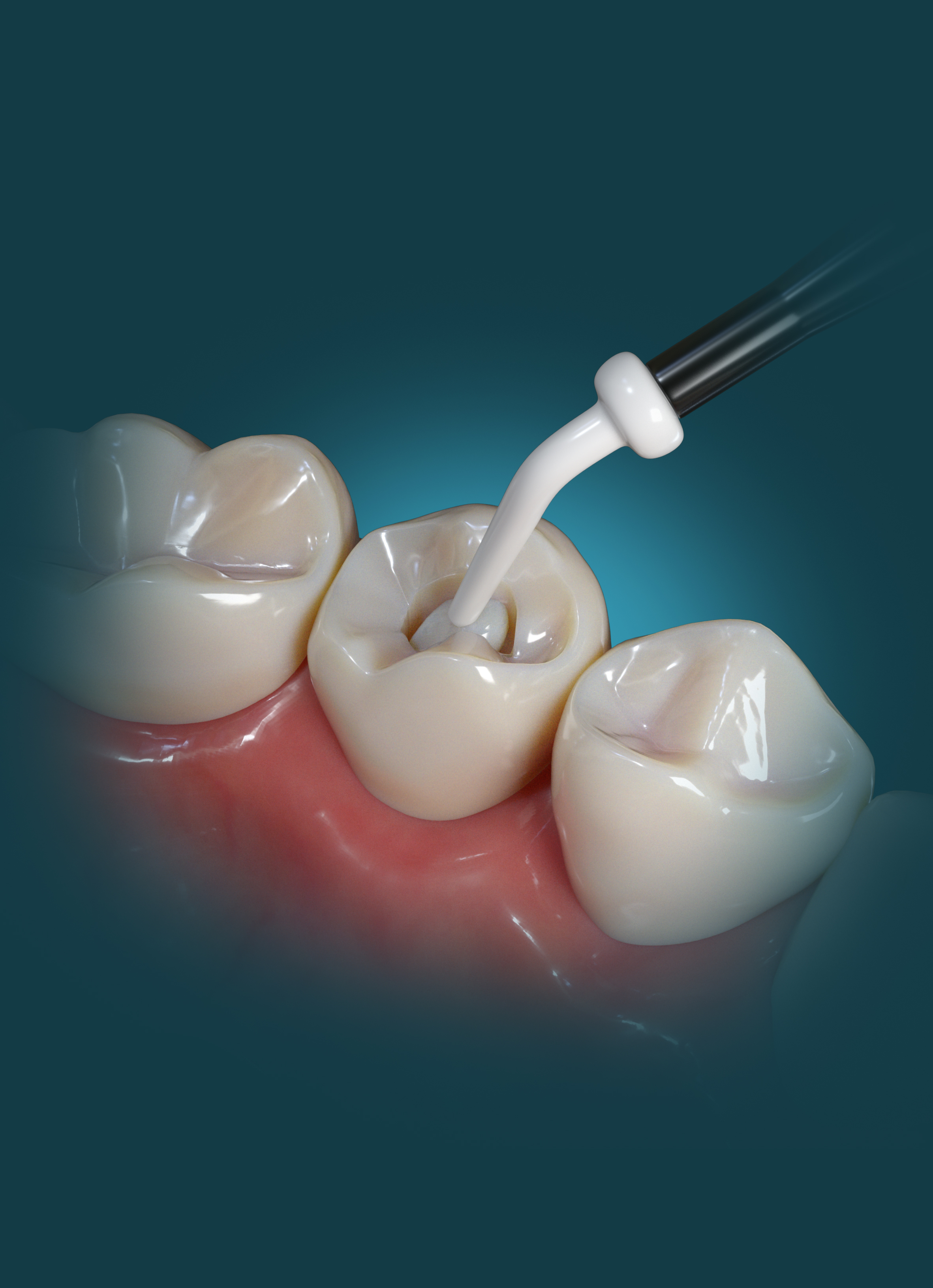 TheDentalGenius - Home